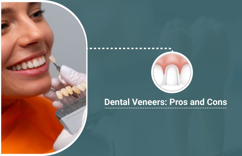 Dental Veneers Pros and Cons - Orca Oral Care Clinic